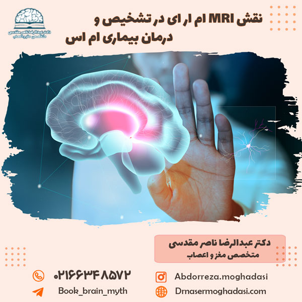 نقش Mri ام ار ای در تشخیص و درمان بیماری ام اس دکتر ناصرمقدسی